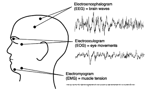 How Covid-19 disturbs patterns of normal brain function, which can ...